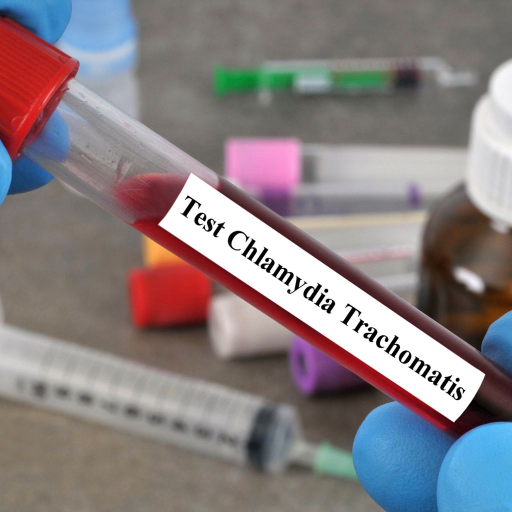 Lymphogranuloma venereum: 20 Jahre Epidemie und kein Ende in Sicht ...