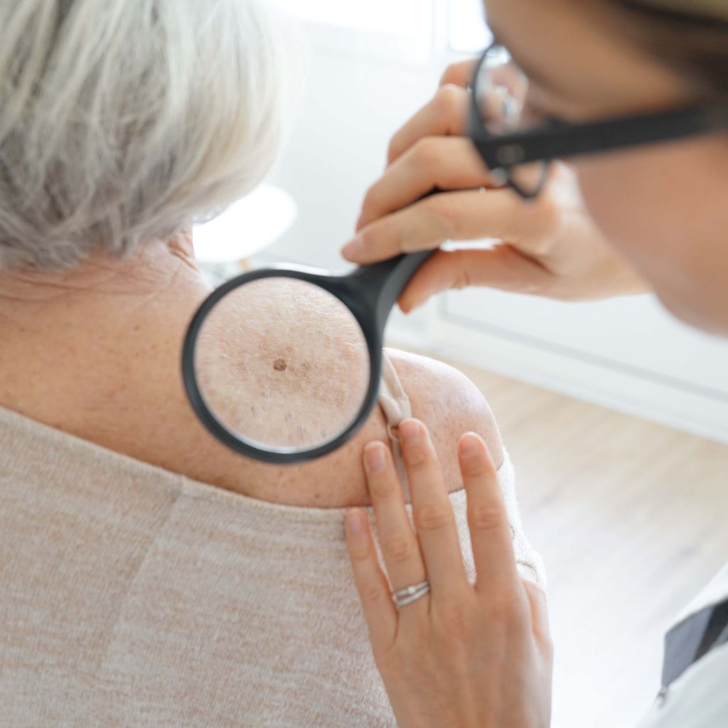 Das Merkelzellkarzinom - Dermatologie - Universimed - Knowledge that ...