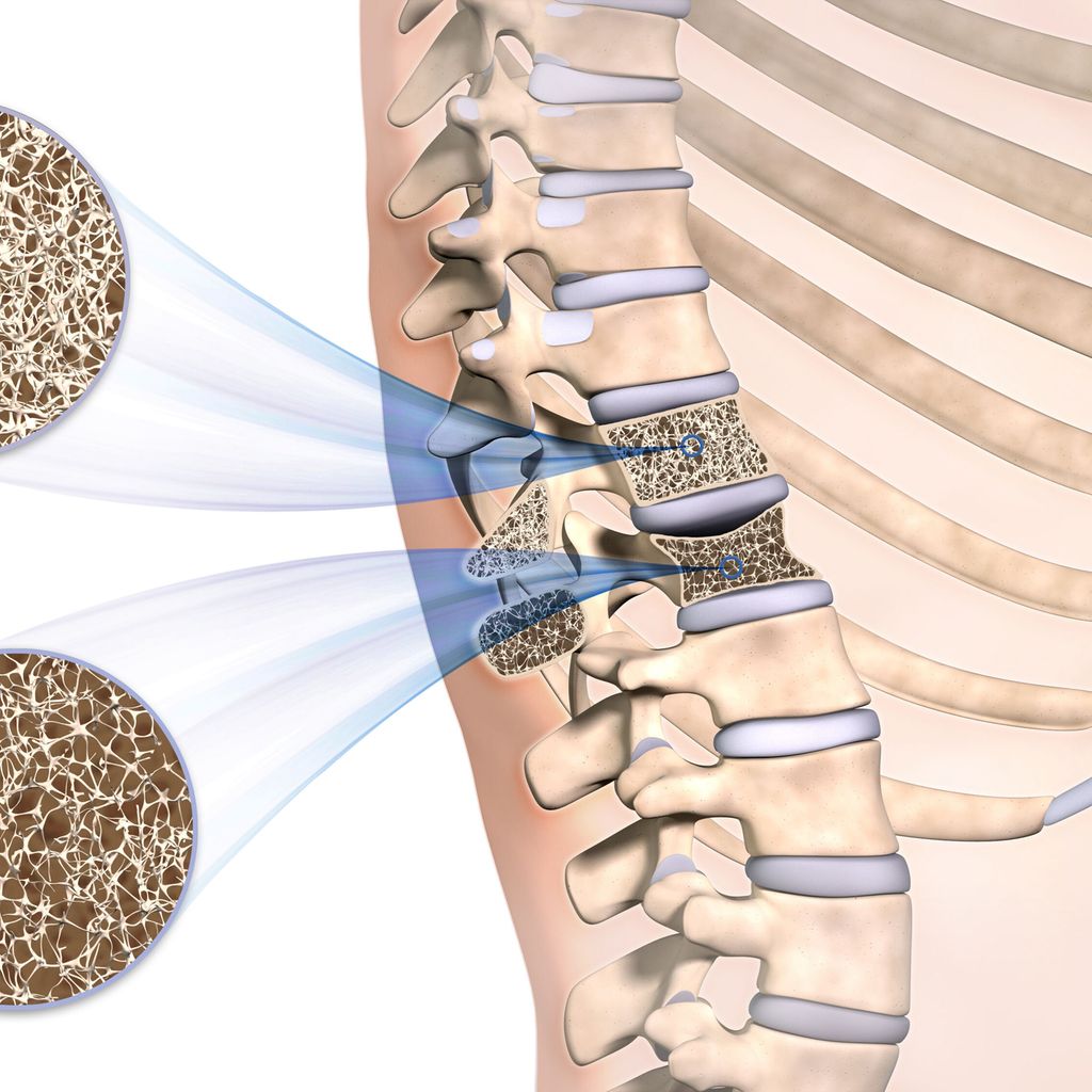 Systemische Sklerose und Knochen - Rheumatologie - Universimed ...