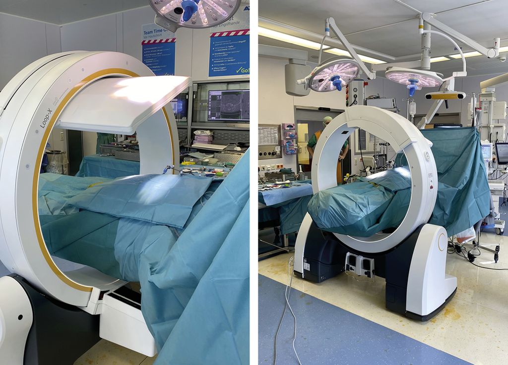 Die Navigation in der Beckenchirurgie mittels LOOP-X - Orthopädie ...