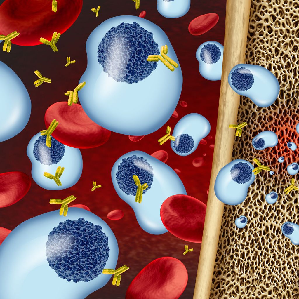 Was war wichtig beim multiplen Myelom? - Onkologie - Universimed ...