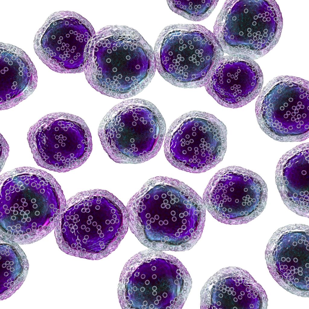 Großzellige B-Zell- und Mantelzell-lymphome: CAR-T-Zell-Therapie ...