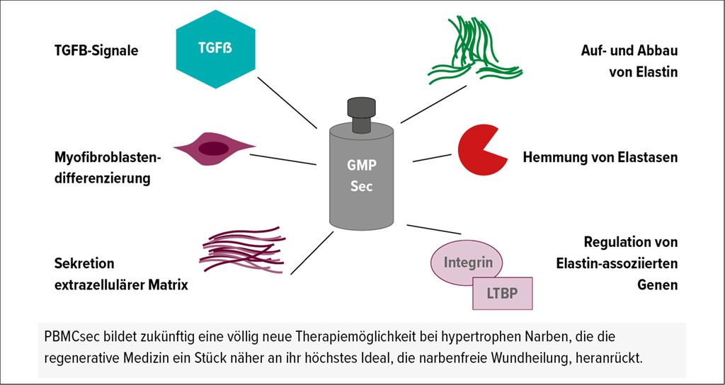 Die Mechanismen von Zellsekretom in Wundheilung und Narbenbildung ...