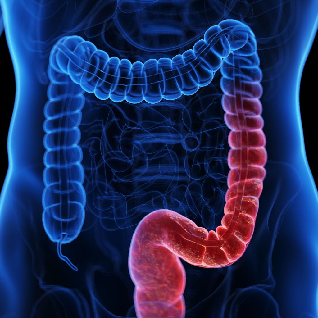 Gestion des poussées aiguës de colite ulcéreuse - Médecine interne ...