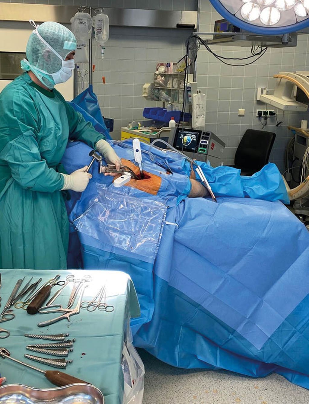 Statische Hakenhalterungssysteme zur Effizienzsteigerung in der minima ...